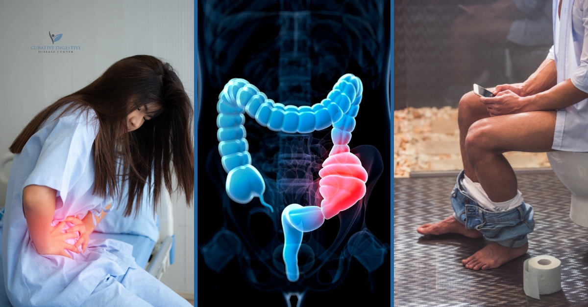 Expert Constipation and Diarrhea Treatment in Houston, TX
